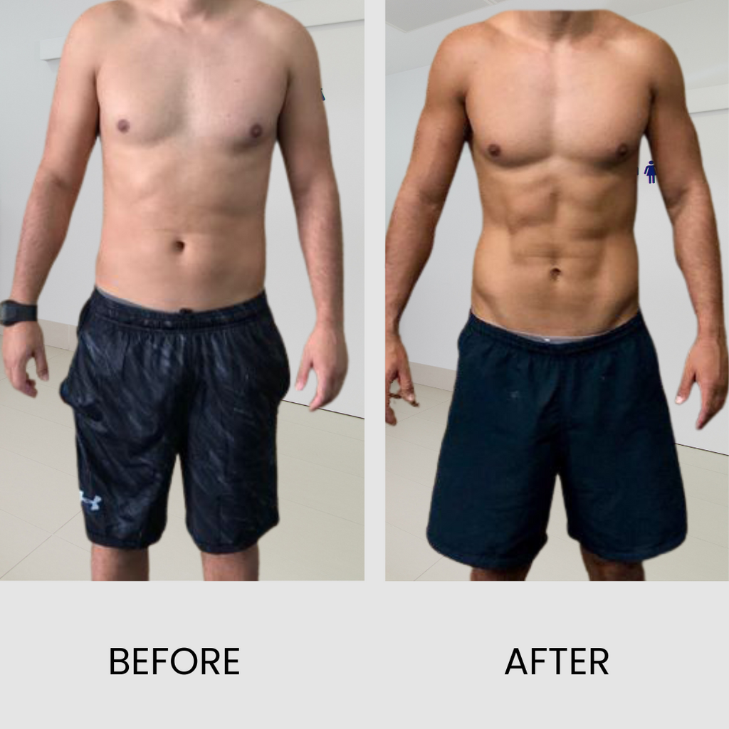 Advanced Body Sculpting Machines | EMShape Neo Factory Main Store
